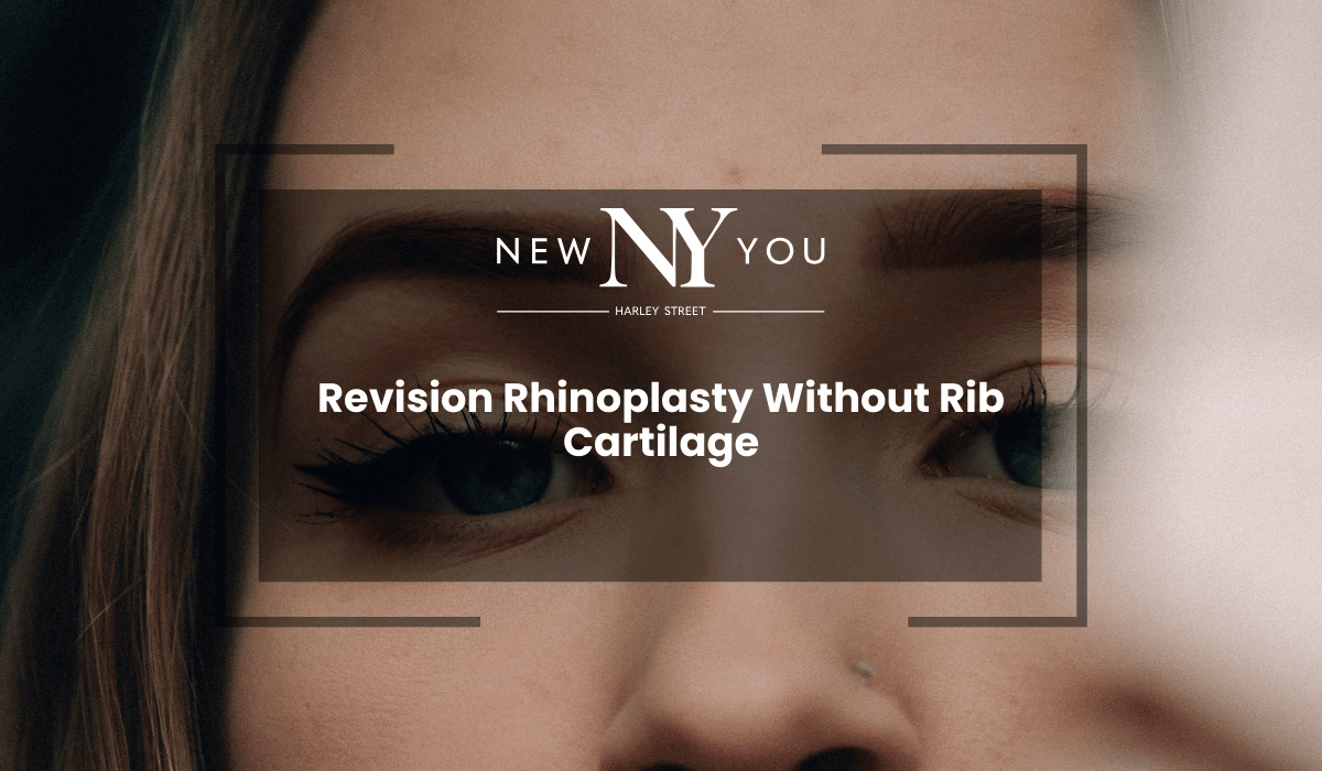 Revision Rhinoplasty Without Rib Cartilage — New You Harley Street