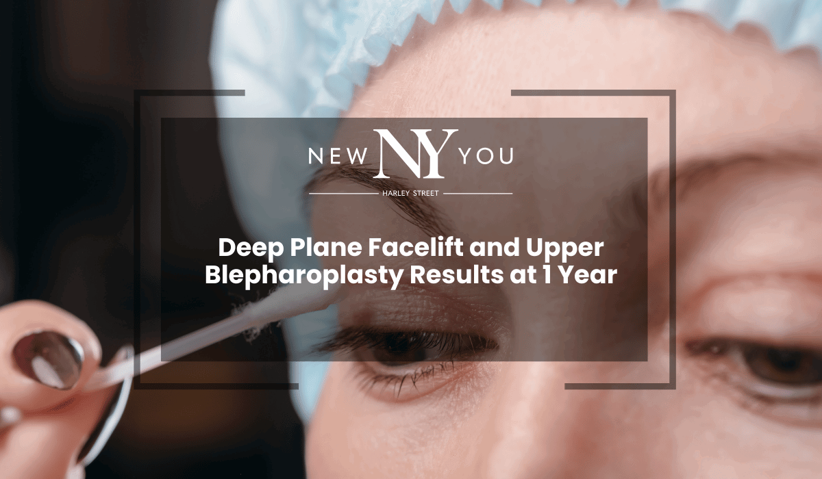Deep Plane Facelift and Upper Blepharoplasty Results at 1 Year — New ...