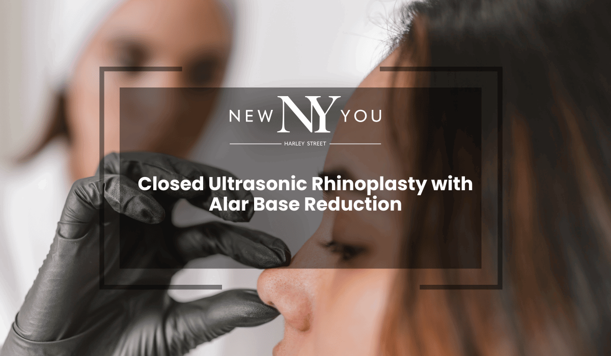 Closed Ultrasonic Rhinoplasty with Alar Base Reduction — New You Harley ...